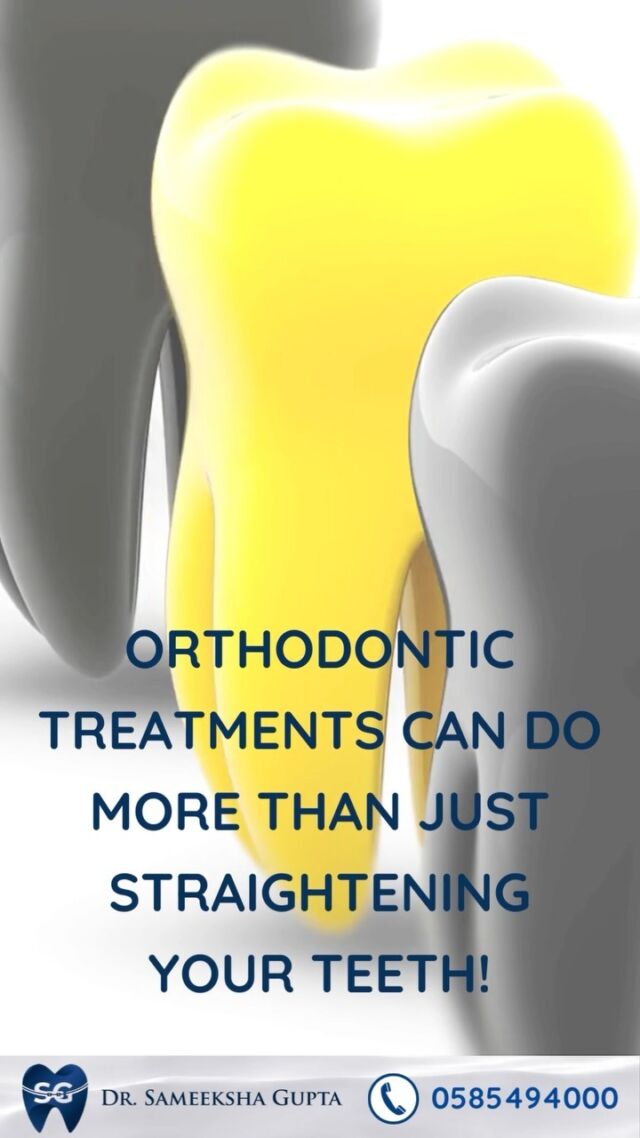 Dental Facts | uaeorthodontist.com